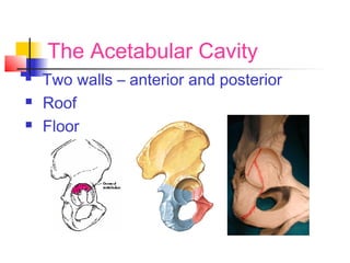Acetabular fraacture management with surgical approaches | PPT