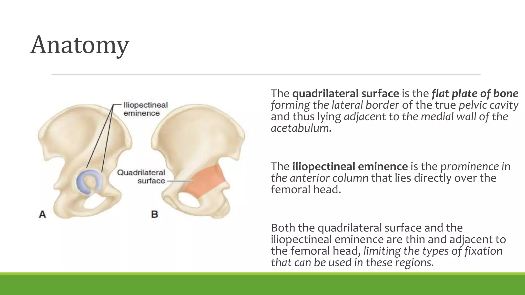 Acetabular | PPTX