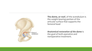 Acetabular | PPT