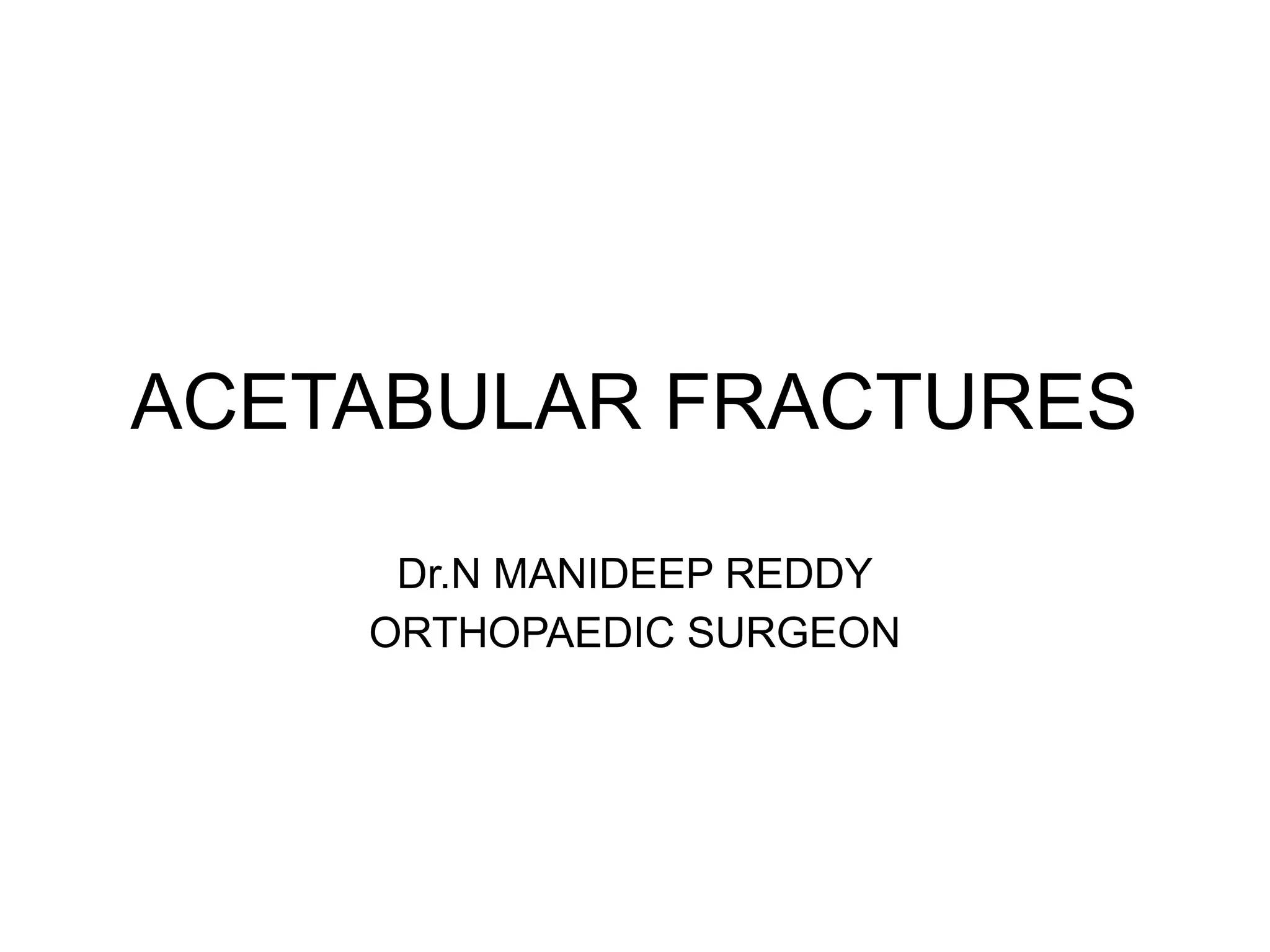 Acetabular fracture etiology and its managements | PPTX