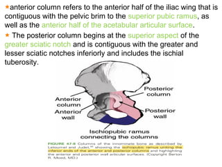 Acetabular fracture etiology and its managements | PPTX