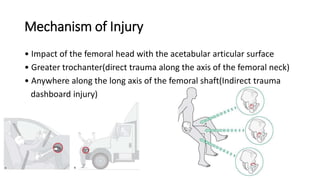 Acetabular Fracture.pptx