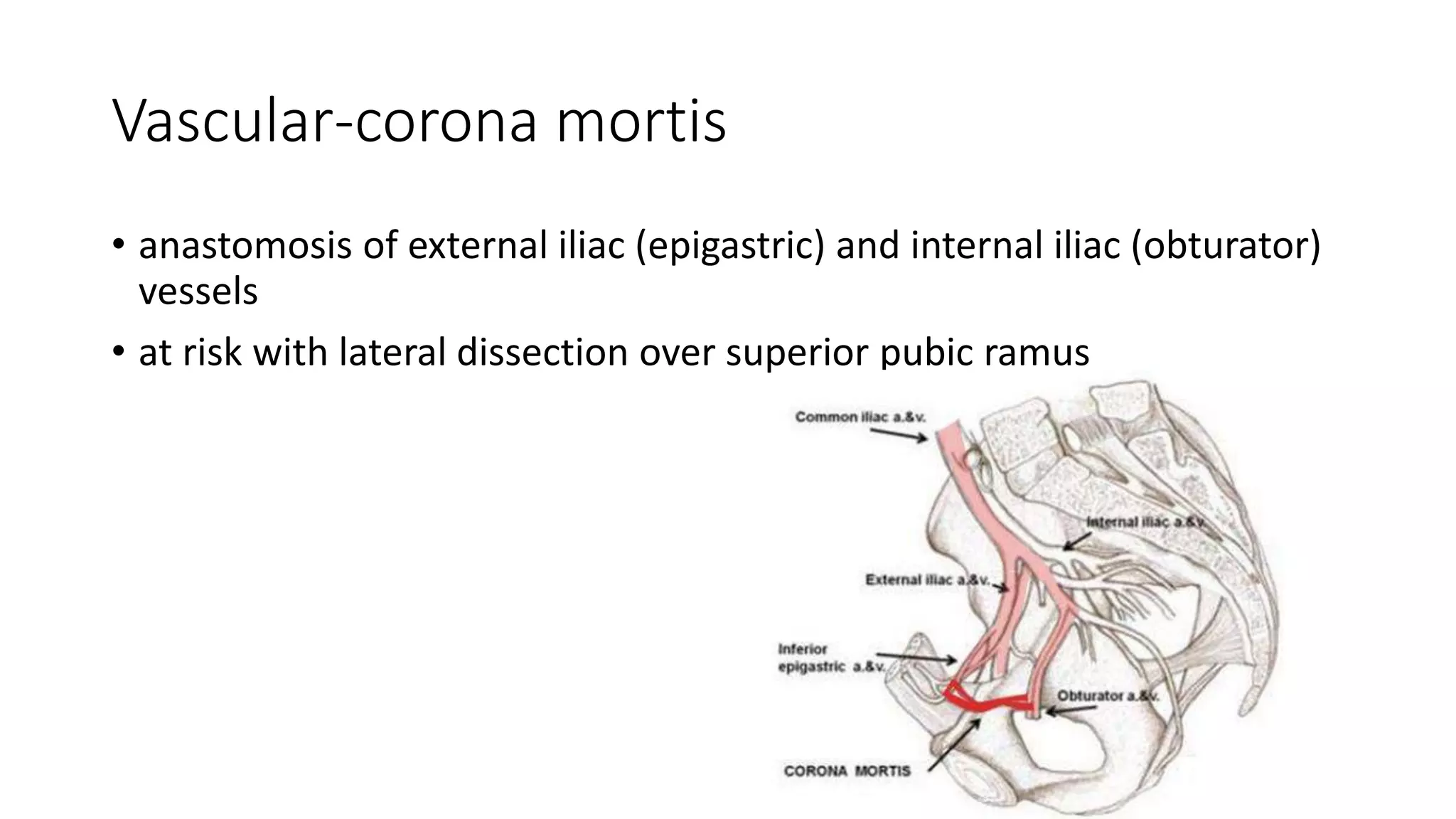 Acetabular fracture new | PPTX