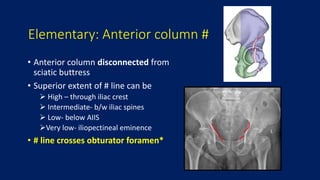 Acetabular fracture ppt 4th sem | PPTX