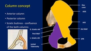 Acetabular fracture ppt 4th sem | PPTX