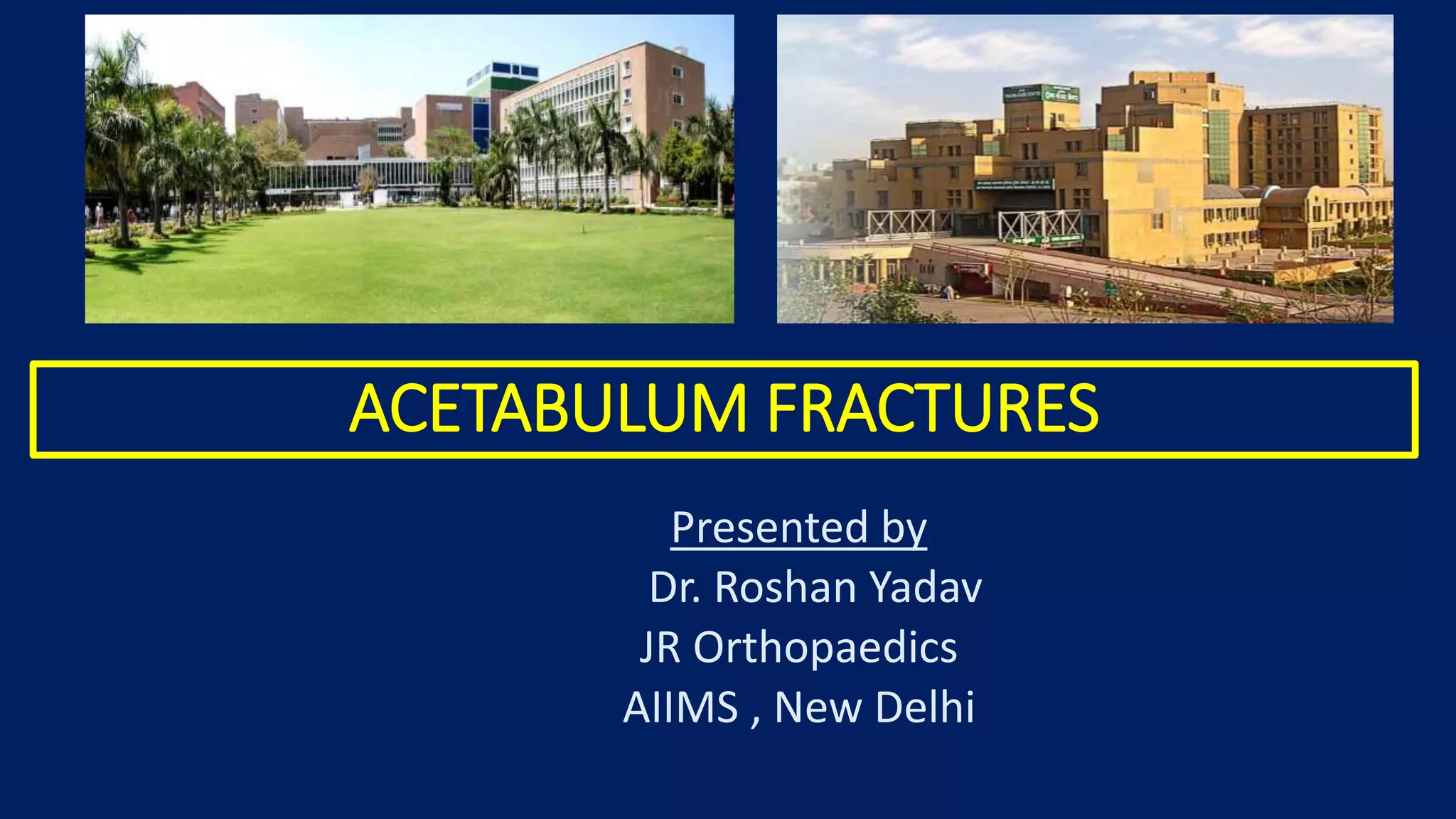 Acetabular fracture ppt 4th sem | PPTX