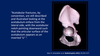Acetabular fracture ppt 4th sem | PPTX