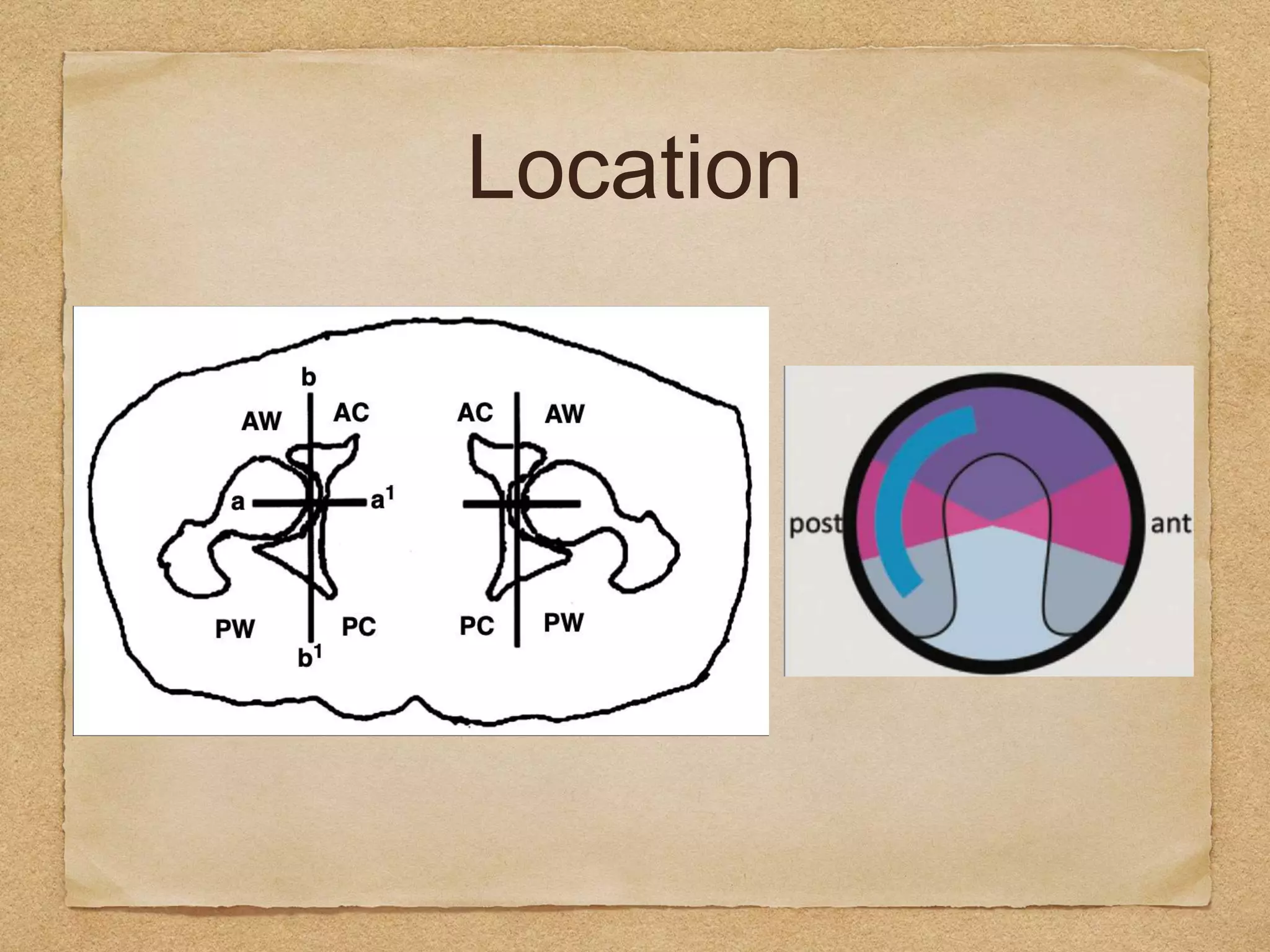 Acetabular Fracture Radiology: Xrays, CT scan & 3D printing | PPTX