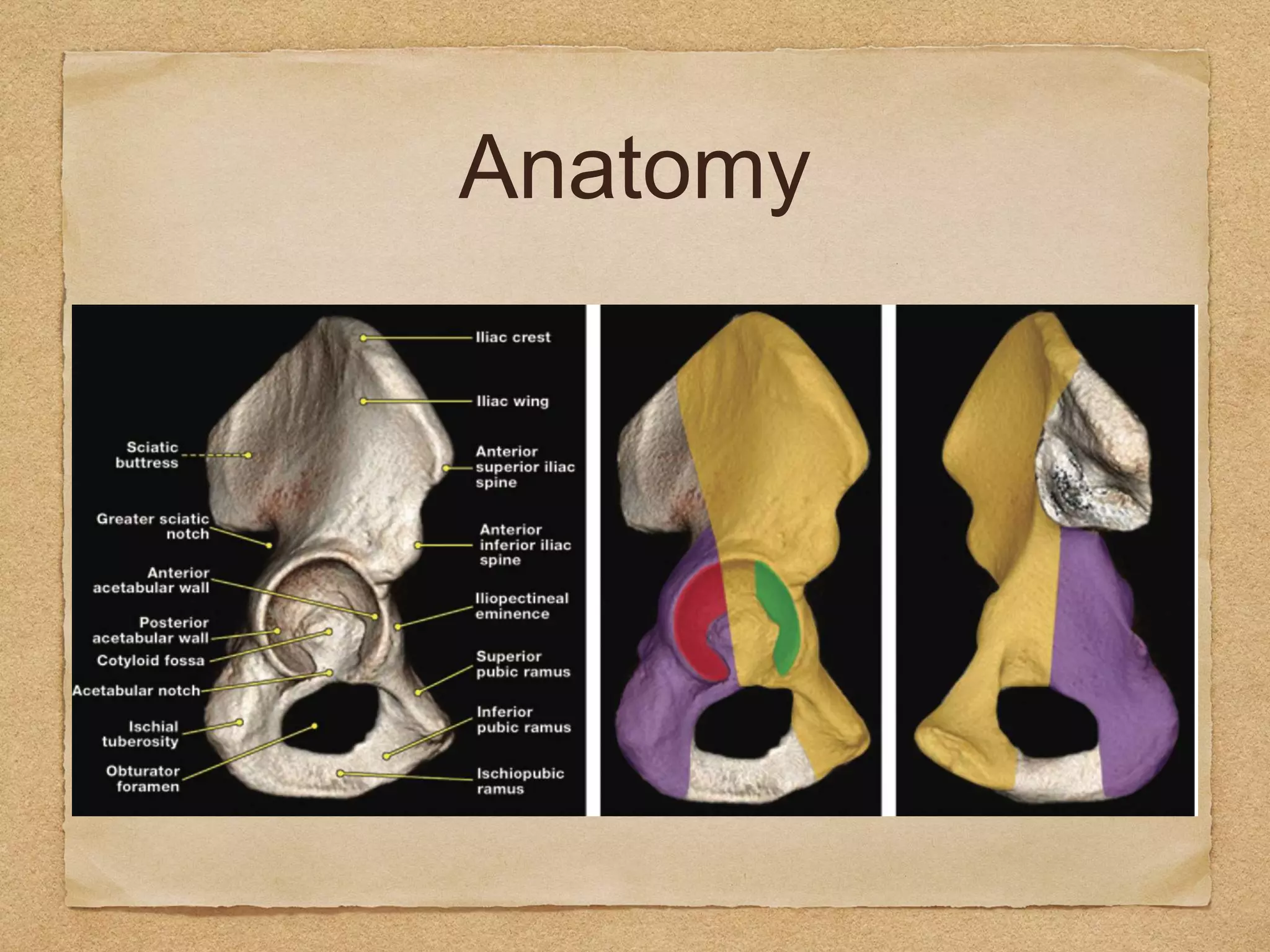 Acetabular Fracture Radiology: Xrays, CT scan & 3D printing | PPTX