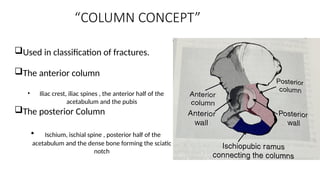 Acetabular Fractures-anatomy, classification s.pptx