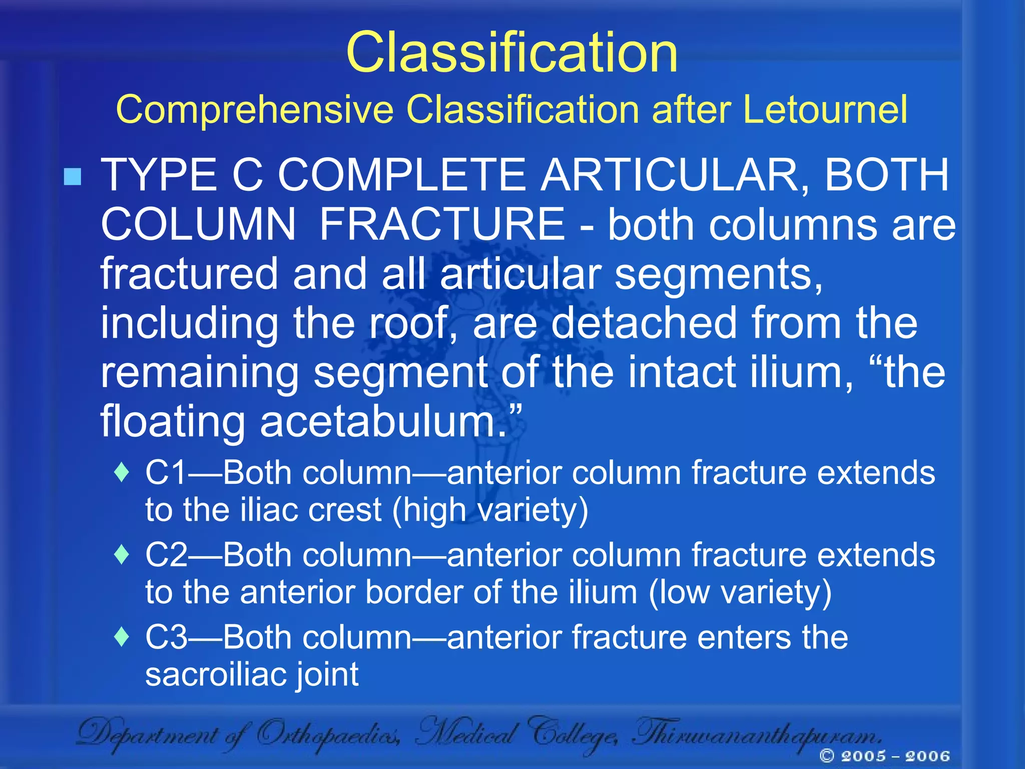 Acetabular fractures | PPT