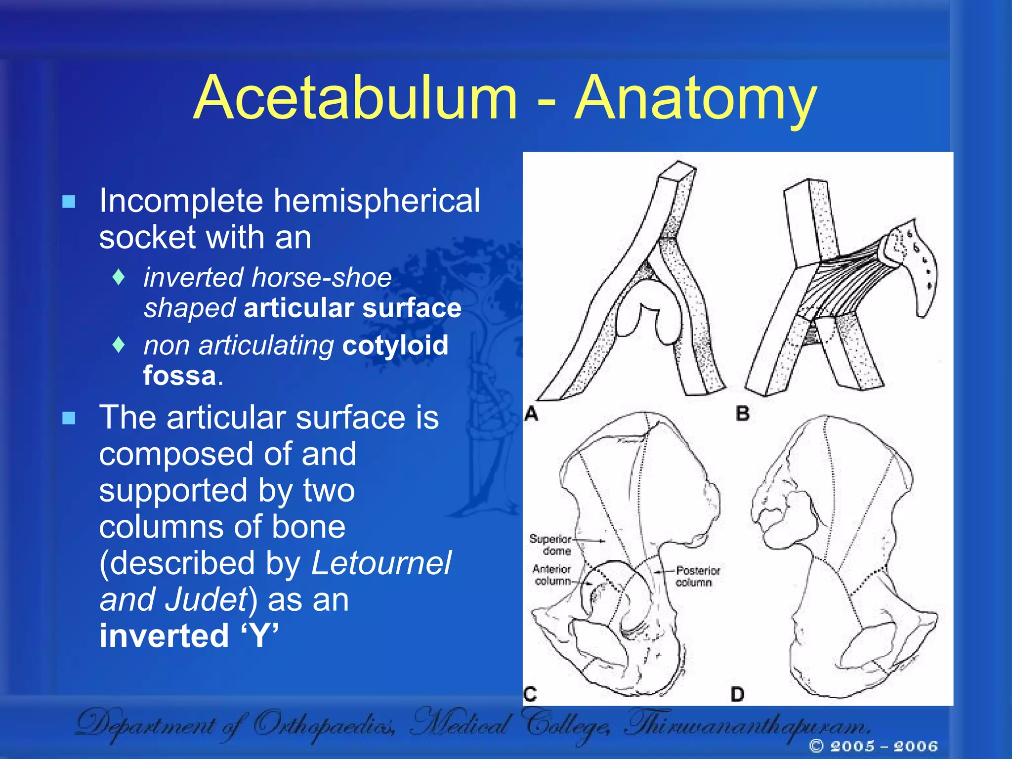 Acetabular fractures | PPT