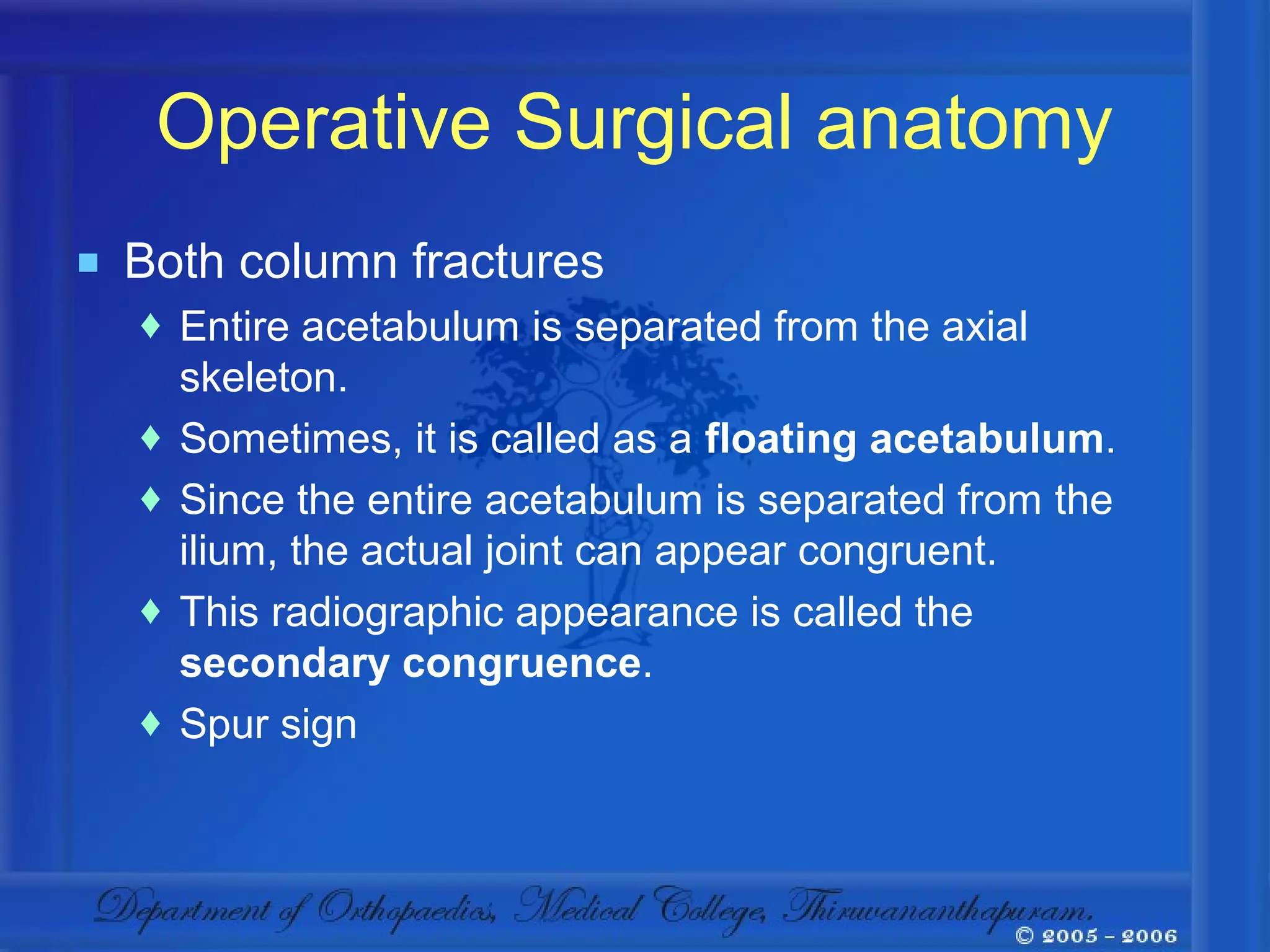 Acetabular fractures | PPT