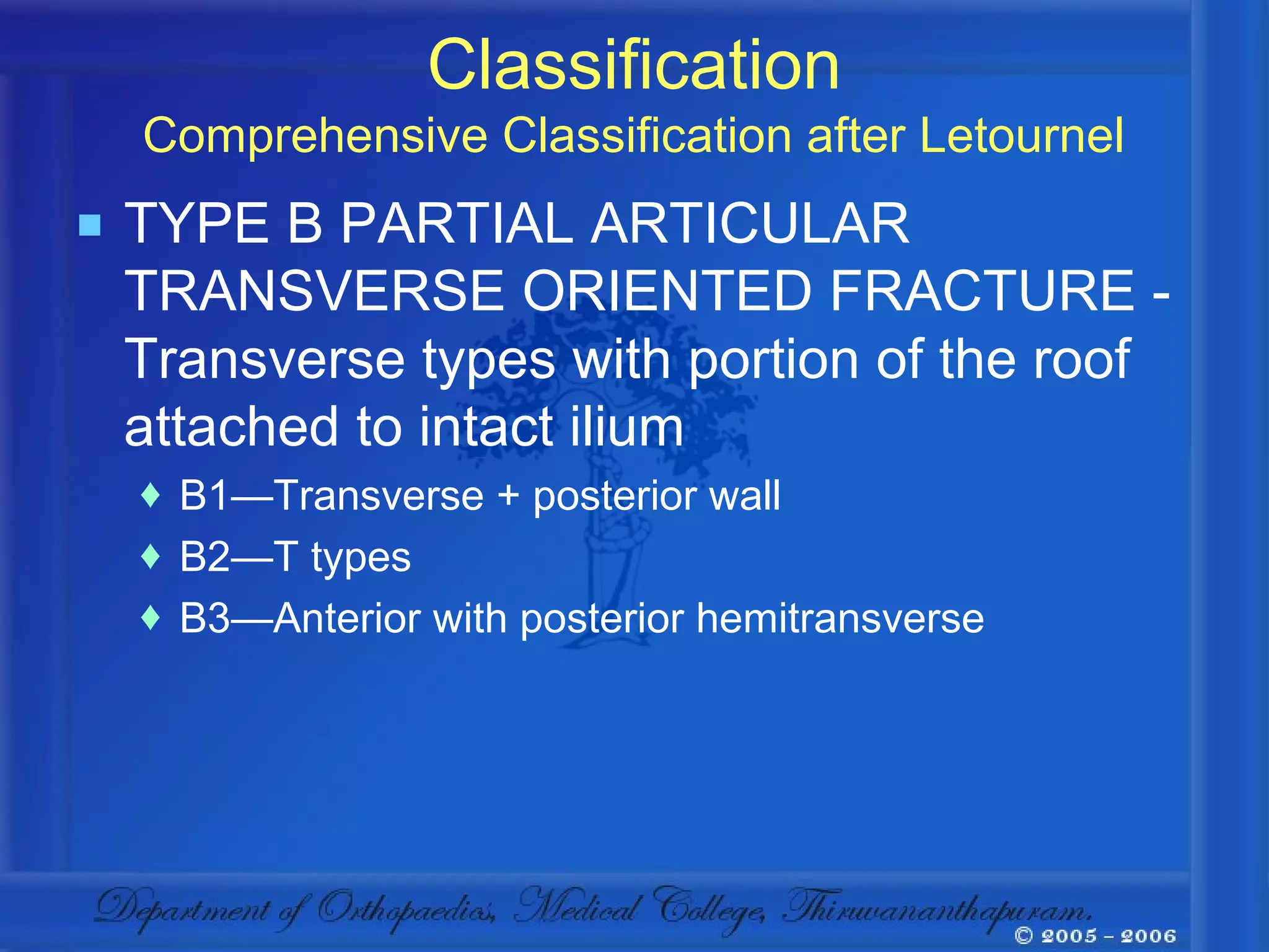 Acetabular fractures | PPT