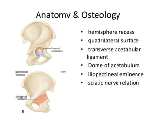 Acetabular fractures | PPTX