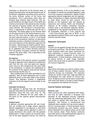 Acetabular fractures | PDF