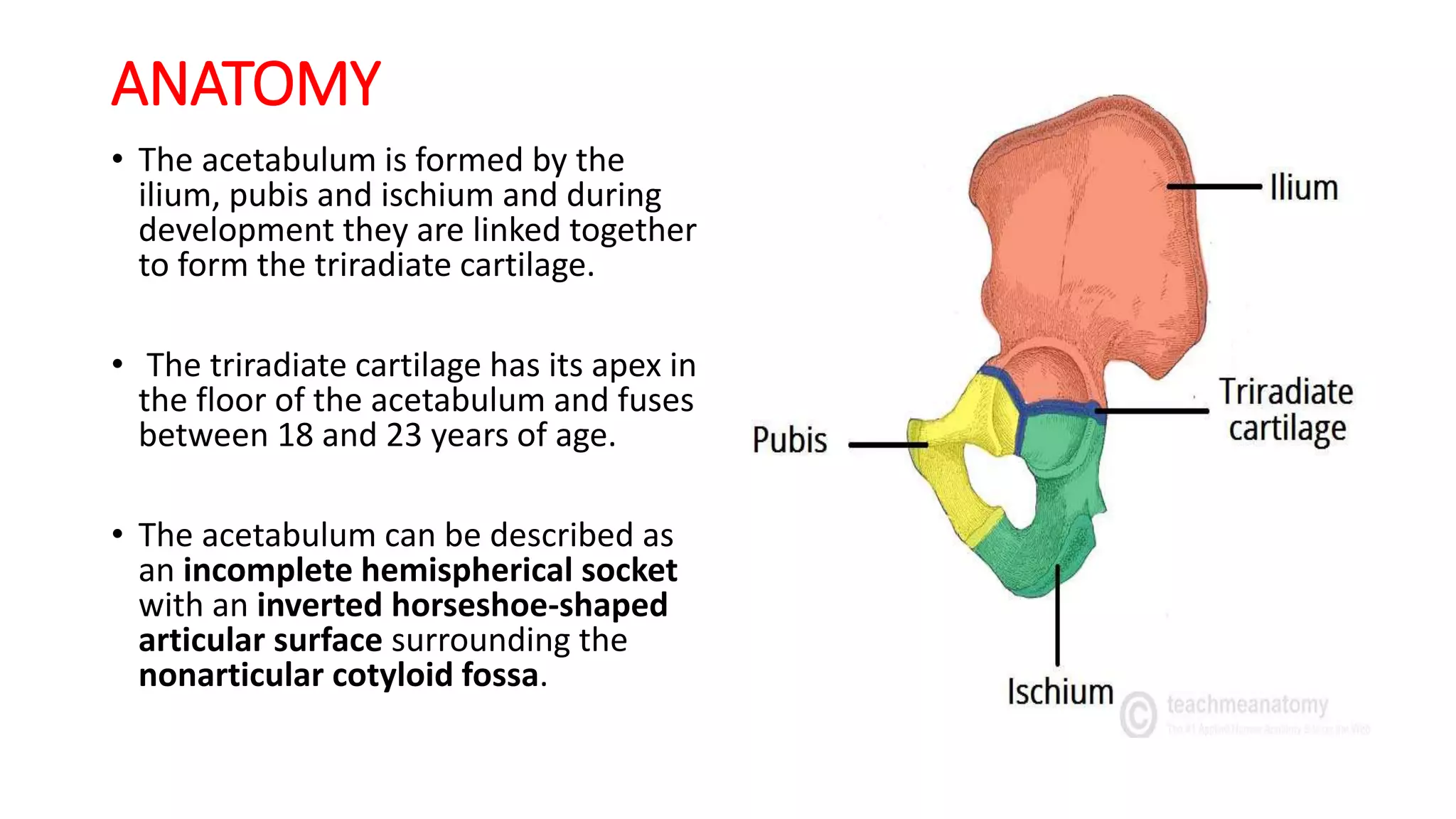 Acetabular fractures | PPTX