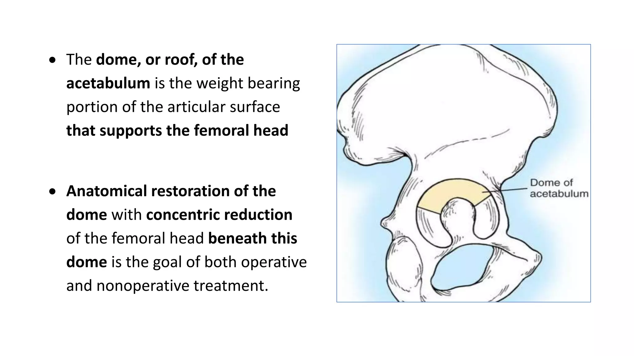 Acetabular fractures | PPTX