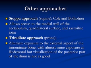 Acetabular fractures.ppt