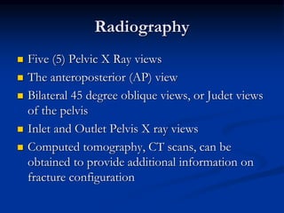 Acetabular fractures.ppt