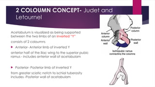 Acetabular fractures- Etiology , clinical features and management | PPTX