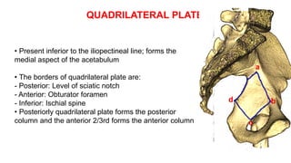 Acetabular Fractures 2.................. | PPTX