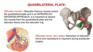 Acetabular Fractures 2.................. | PPTX