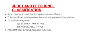 Acetabular Fractures 2.................. | PPTX
