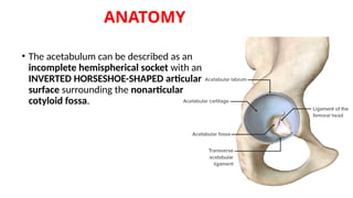 Acetabular Fractures 2.................. | PPTX