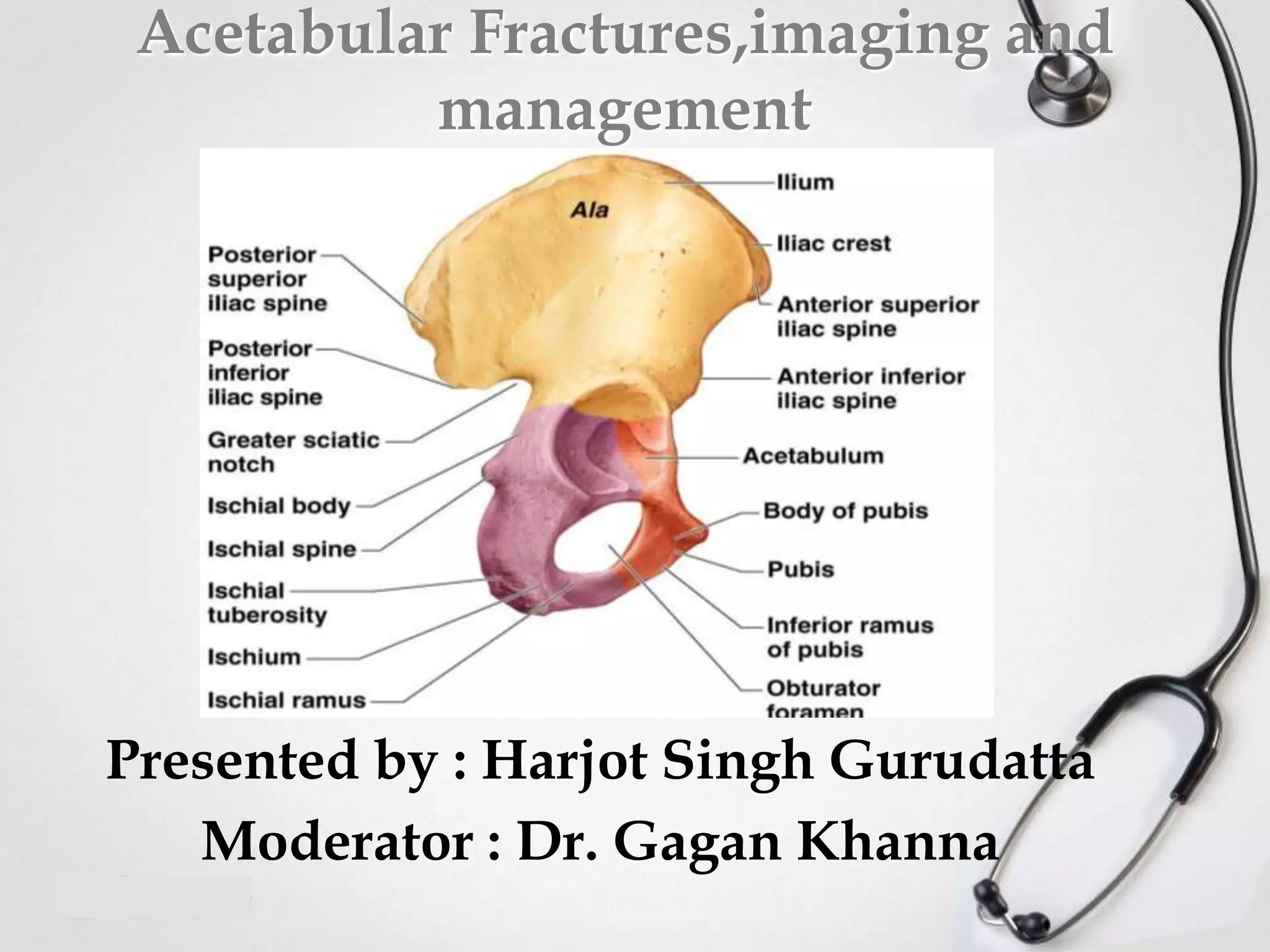 Acetabular fracture | PPTX