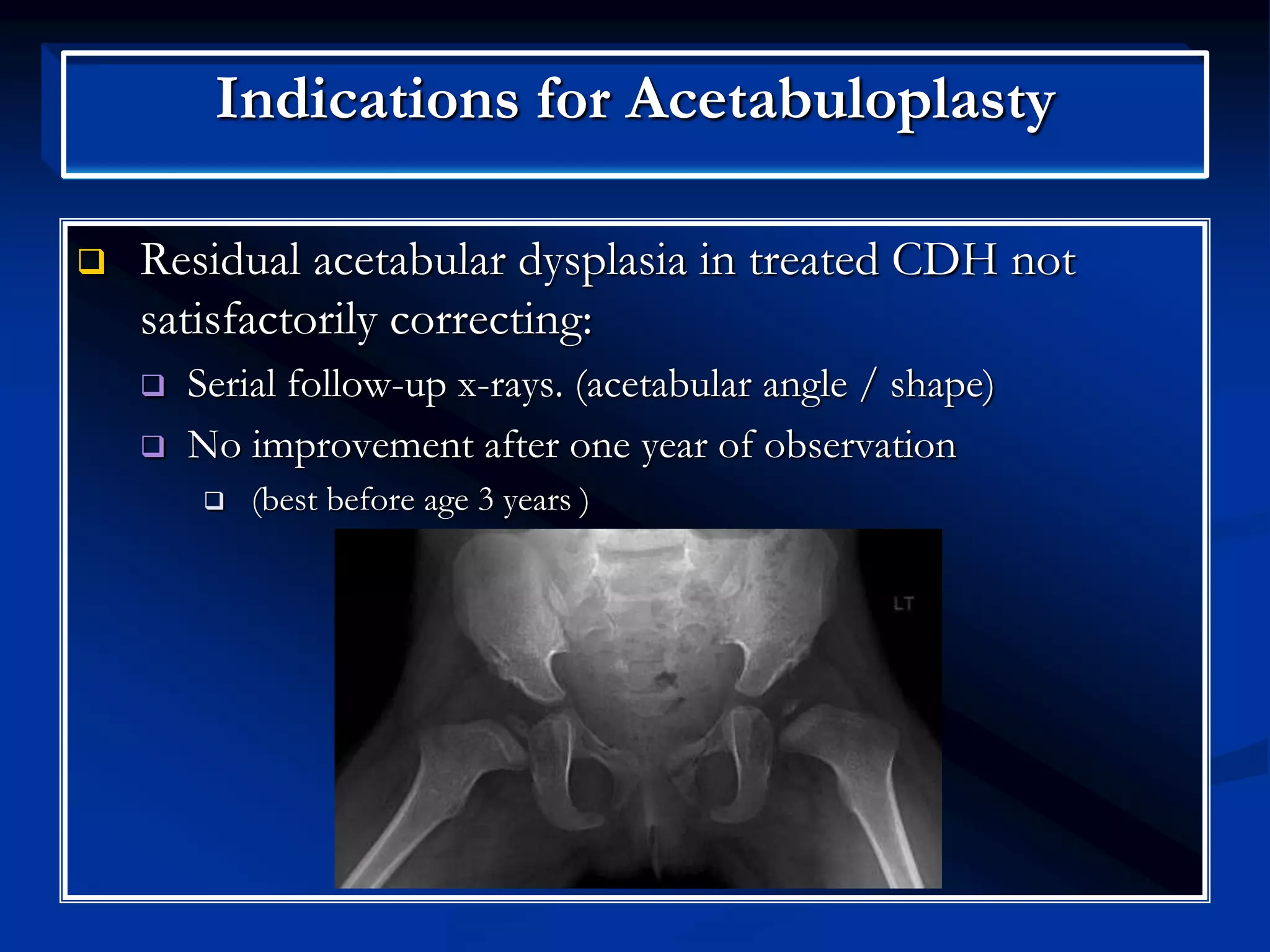 Acetabuloplasty indications | PPT