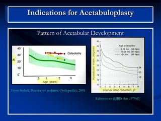 Acetabuloplasty indications | PPT