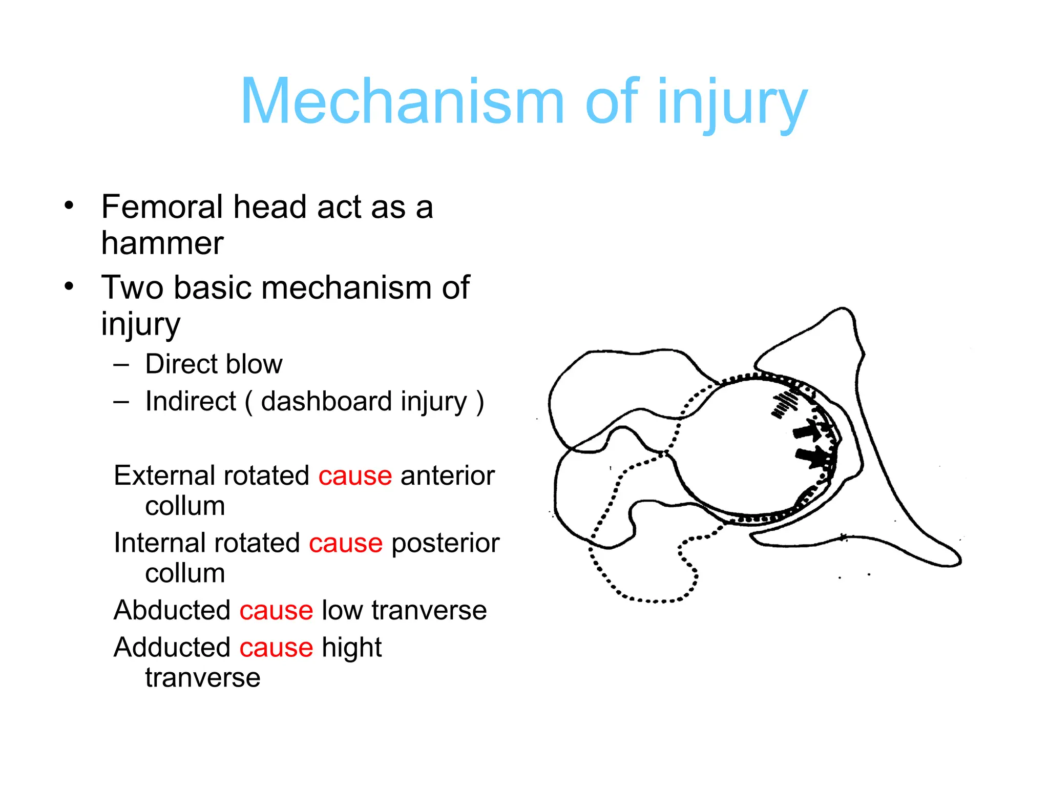 Acetabulum management fracture surgery.ppt