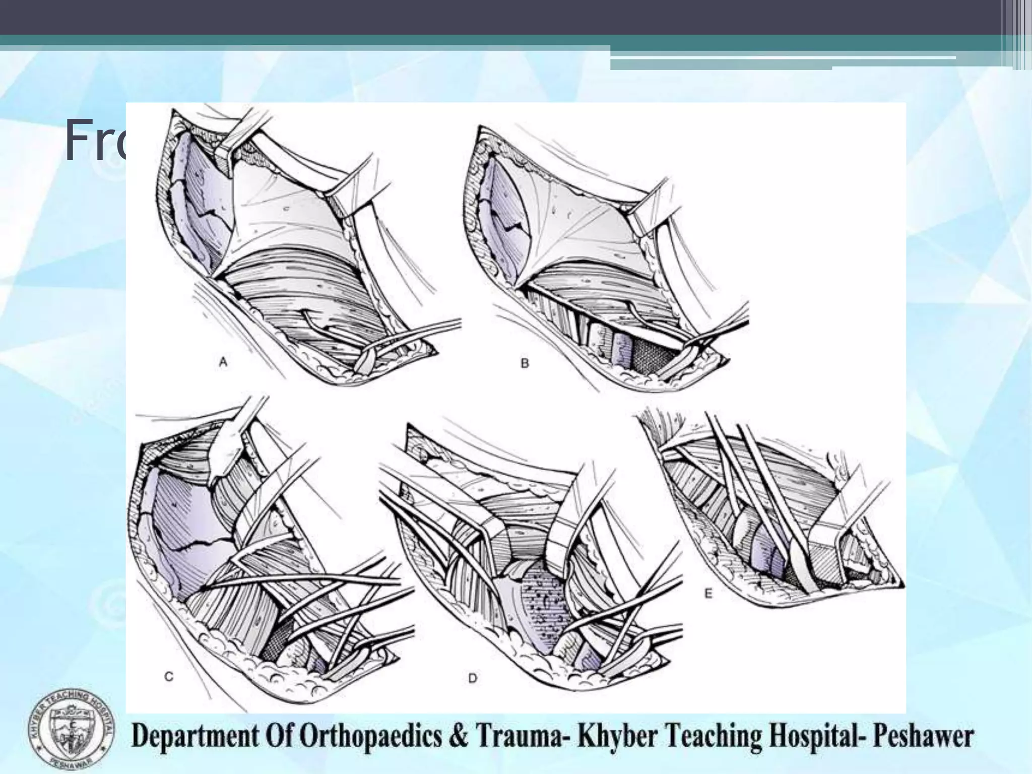 Acetabulum anatomy | PPTX