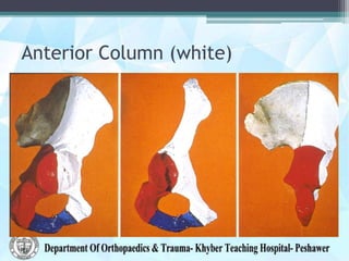 Acetabulum anatomy | PPTX