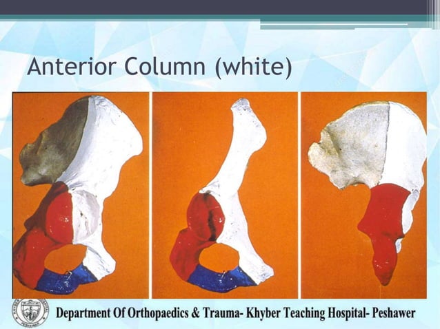 Acetabulum anatomy | PPTX
