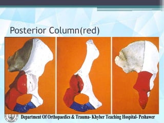 Acetabulum anatomy | PPTX