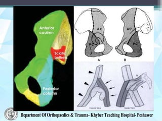 Acetabulum anatomy | PPT
