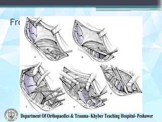 Acetabulum anatomy | PPT