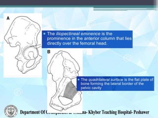 Acetabulum Anatomy