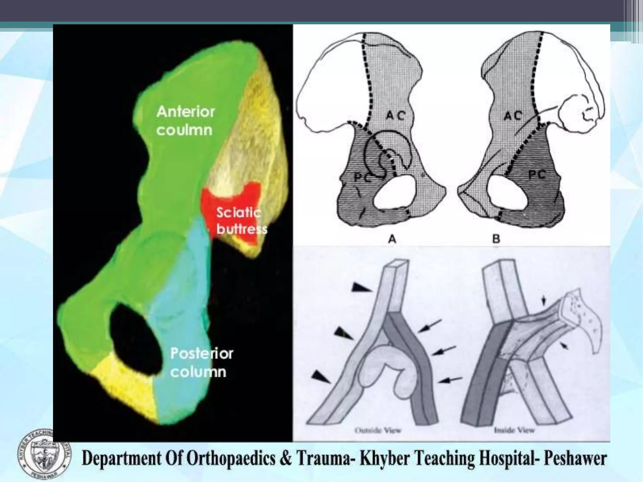Acetabulum anatomy | PPTX