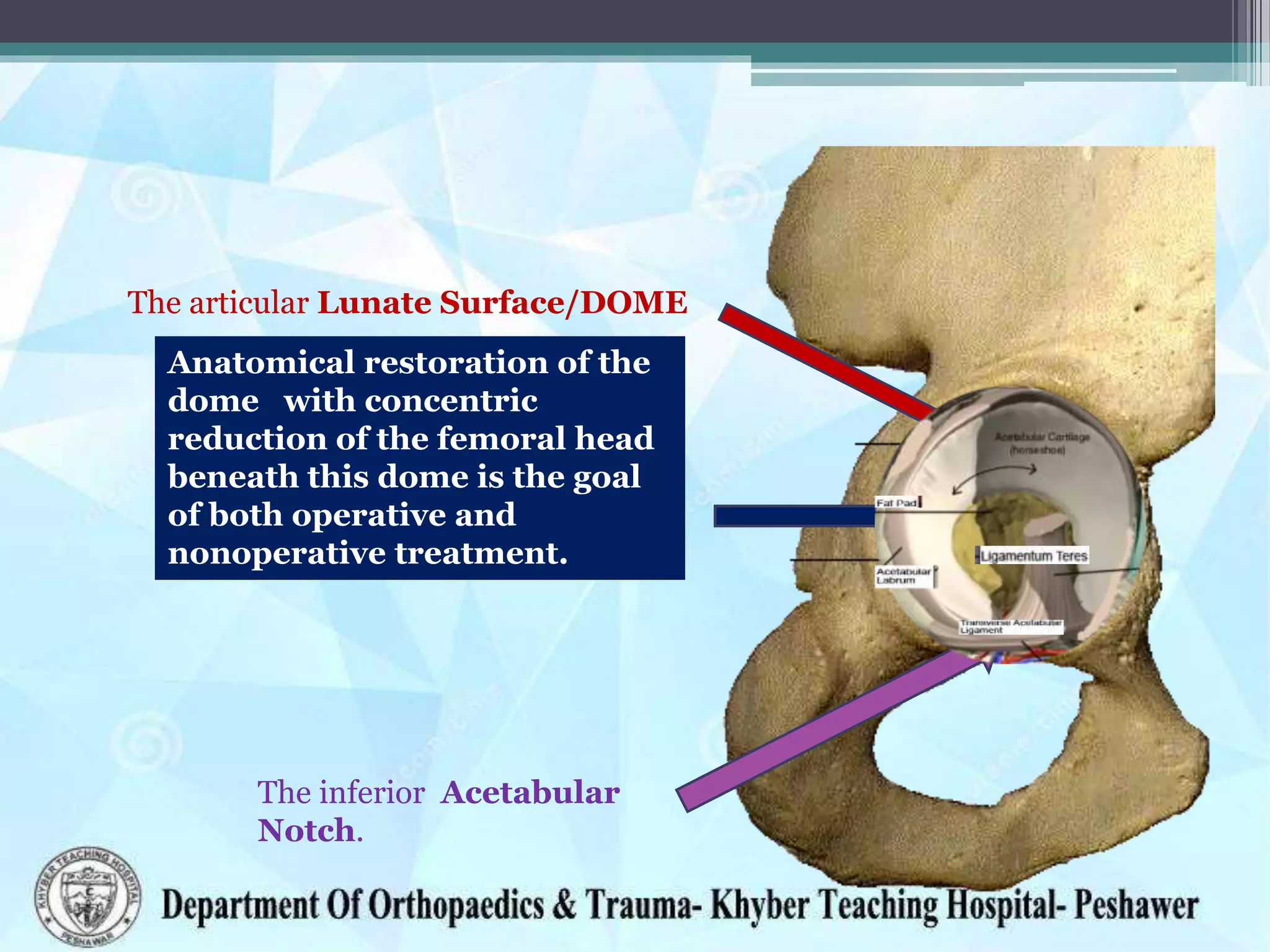 Acetabulum anatomy | PPTX
