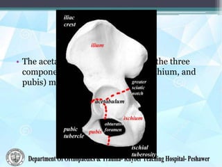 Acetabulum anatomy | PPTX