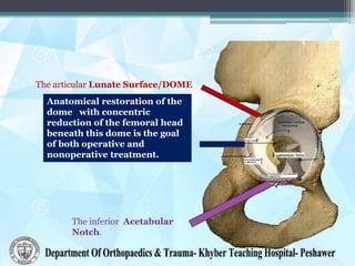 Acetabulum anatomy | PPTX