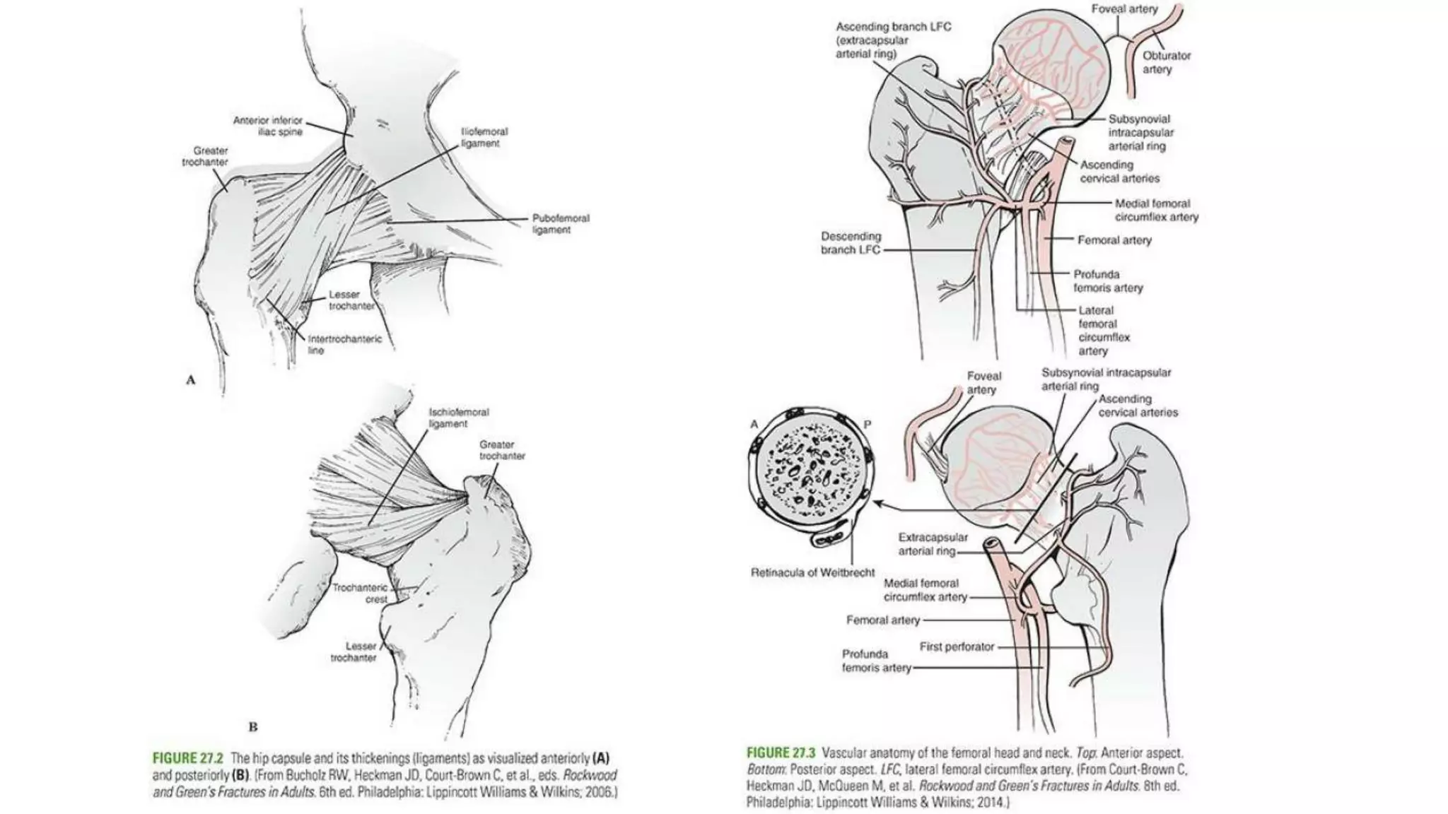 ACETABULUM And HIP DISLOCATION Report.pptx