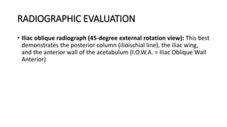 ACETABULUM And HIP DISLOCATION Report.pptx