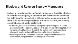 ACETABULUM And HIP DISLOCATION Report.pptx