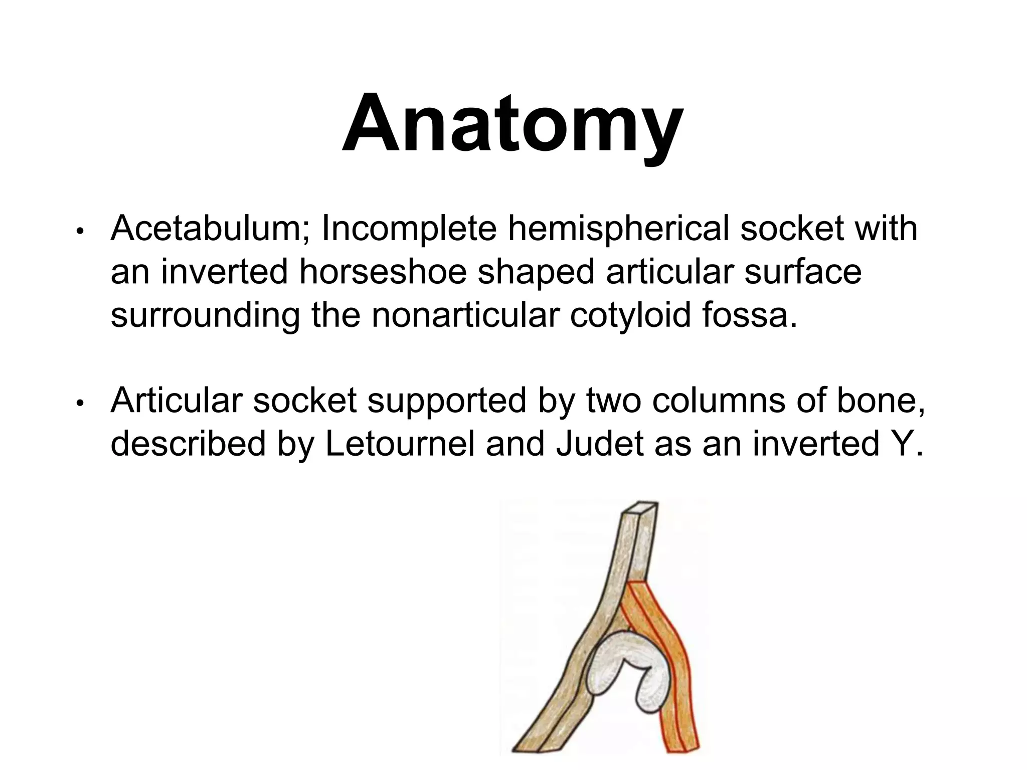 Acetabulum Fracture | PPTX