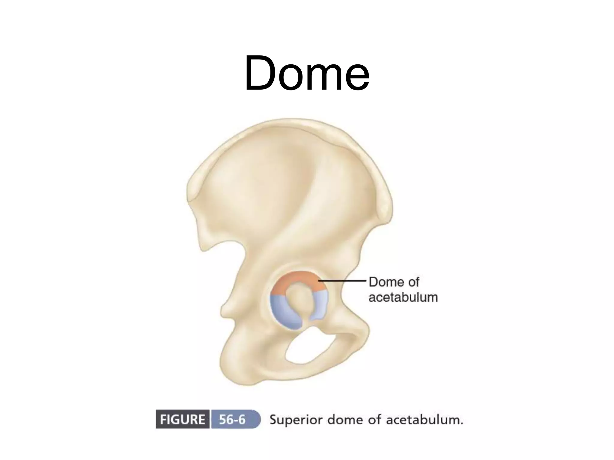 Acetabulum Fracture | PPTX