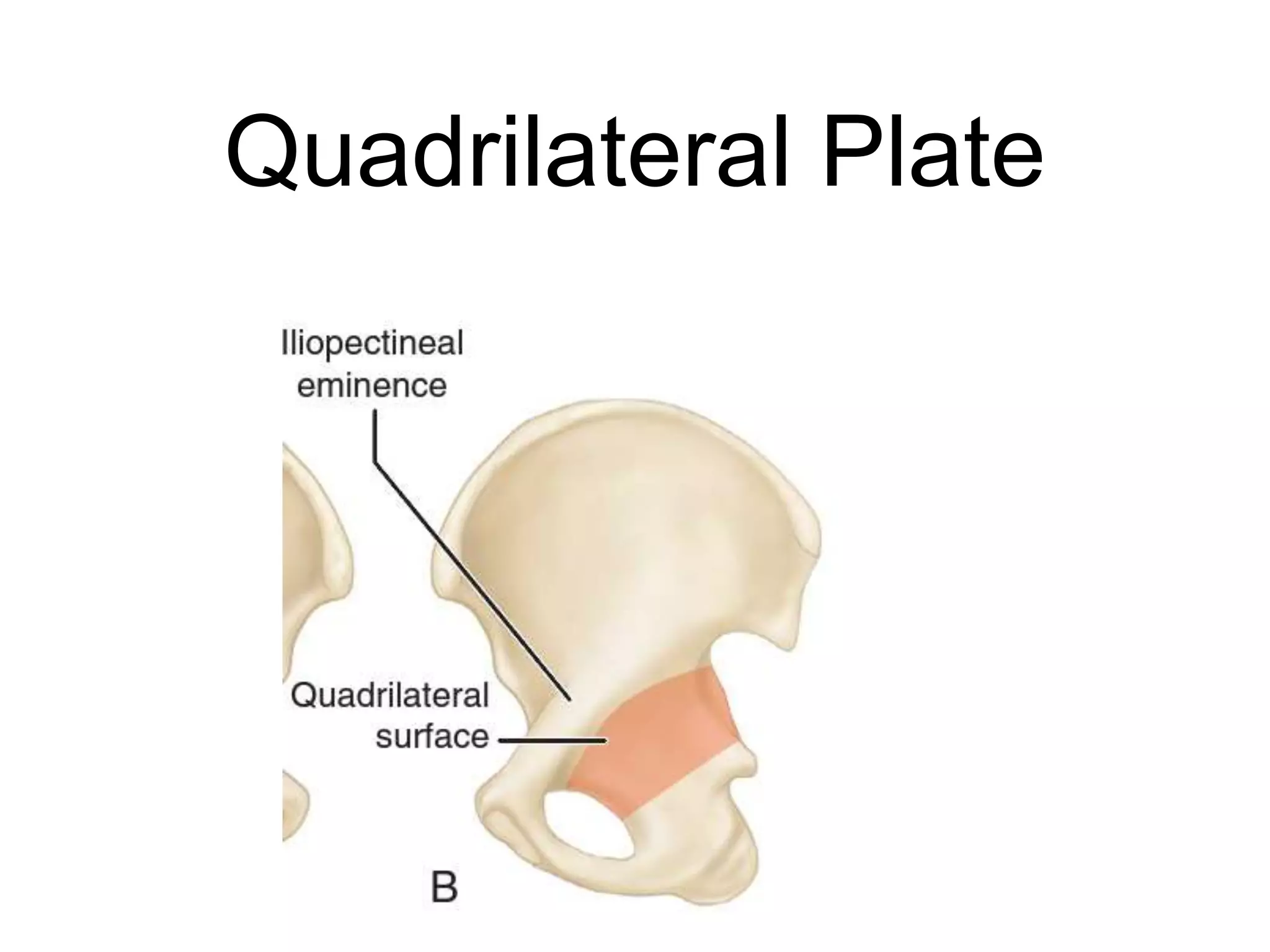 Acetabulum Fracture | PPTX